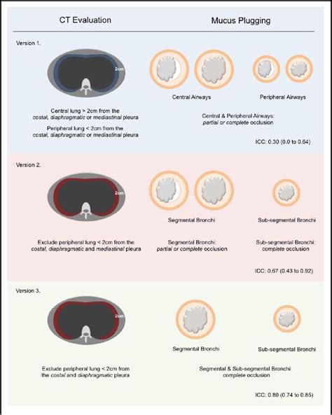 Figure 11 From An Investigation Of Mucus Plugging In Severe Asthma