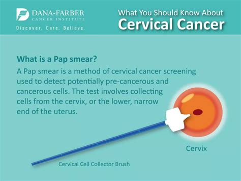 What You Should Know About Cervical Cancer Ppt