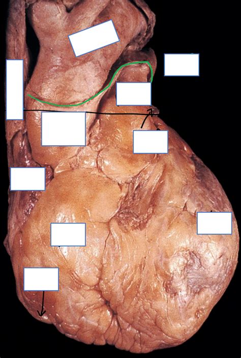 Heart Surface Features Cadaver Diagram Quizlet