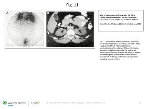This Powerpoint Document Contains The Images That You Requested Ppt