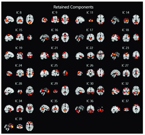 The Results Of Ica Of Fmri And Removal Of Noise And Artifacts After Download Scientific