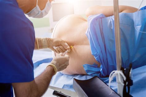 Epidural Steroid Injection For Augusta Asc And Augusta Clinic Augusta Austell Austell