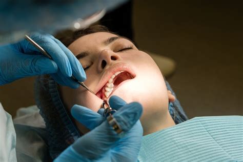 4 Common Oral Surgery Procedures Synergy Dental Group Of Oc Ladera