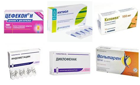 Свечи при аднексите (сальпингоофорите): противовоспалительные ...