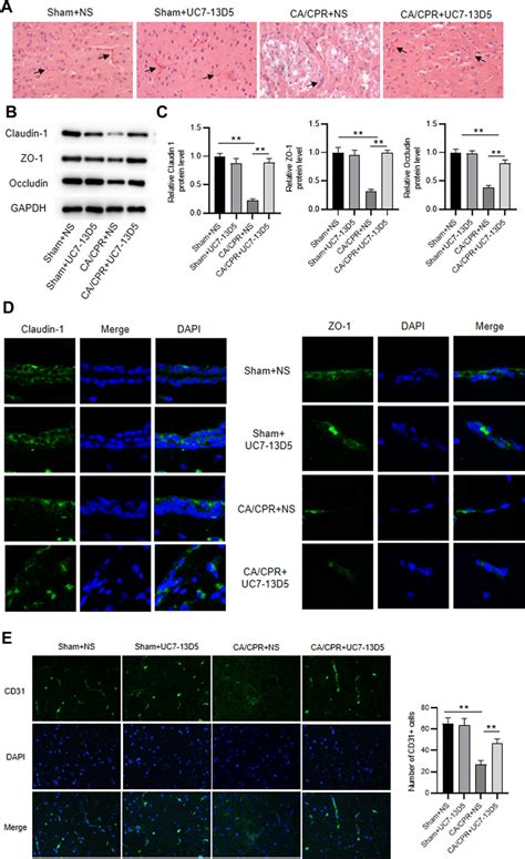Inhibition Of γδt Cells Attenuates Bbb Disruption And Promotes Download Scientific Diagram