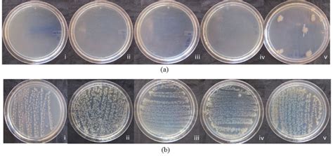Nutrient Agar Plates Showing Bacterial Count At Different Time Interval