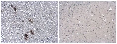 Anti Beta Amyloid 1 42 Antibody Conformation Specific Gtx134510