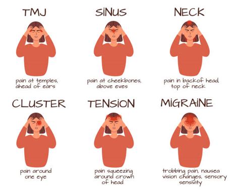 Cluster Headaches Diagram