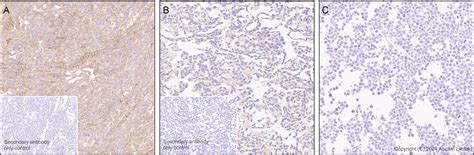 Antigen Retrieval 100x Citrate Buffer Ph 51 55 125 250 Ml