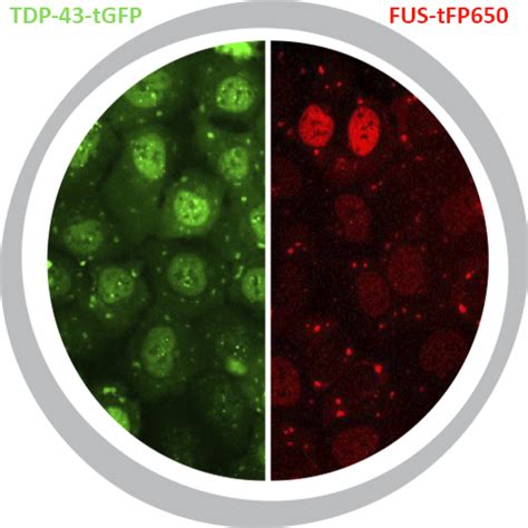TDP43 FUS Cell Line Innoprot Stable Cell Lines For ALS Research