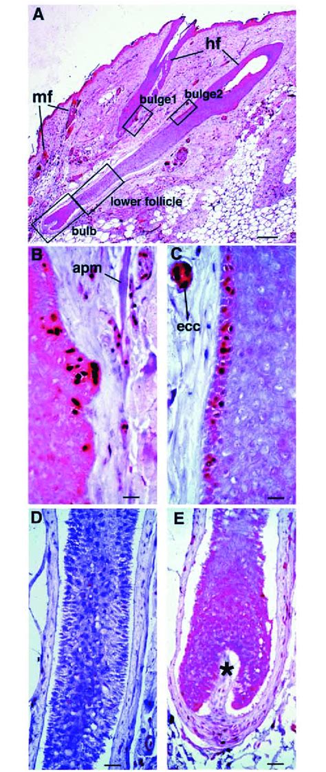 Human Scalp Under Microscope Labeled