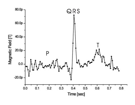 Reconstructed Cardiac Pulse The Signal Is Averaged Over A Set Of About Download Scientific