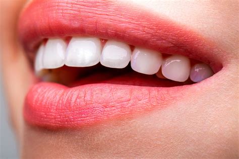 Common Teeth Whitening Myths Debunked Center City Emergency Dentist