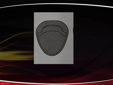 Tooth Preparation For Metal Ceramic Crowns Ppt