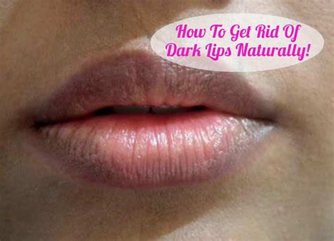 How To Rid Of Dark Lips
