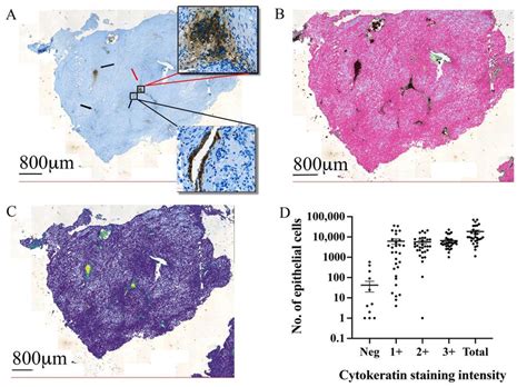 Cytokeratin And Automated Identification Of Epithelial Cells In Download Scientific Diagram