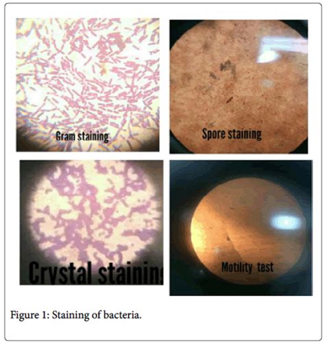 Isolation And Identification Of Bacillus Thuringiensis And Corrob
