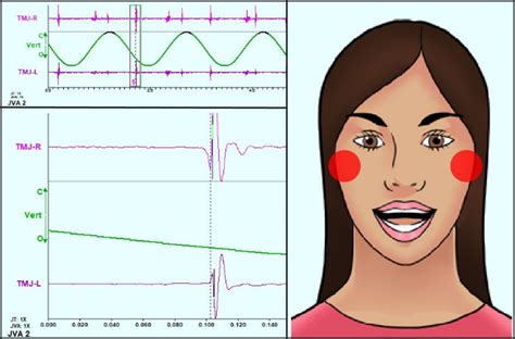 Comparison Of The Joint Vibration Analysis Jva Flow Chart To Mr