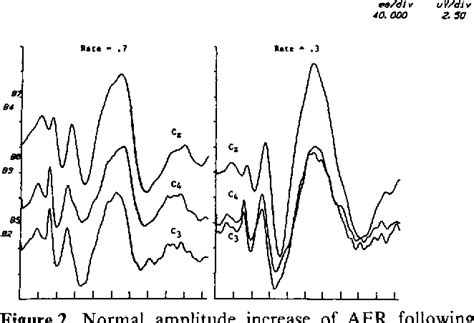 Figure 1 From Auditory Evoked Potential And Psychiatry Semantic Scholar