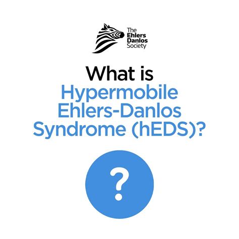 The Most Common Of The Eds Types But Yet One I Have Seen So Poorly Treated… Jacqui Main