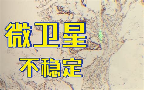 结直肠癌微卫星不稳定 小崔病理 小崔病理 哔哩哔哩视频