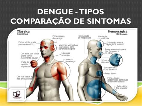 Dengue Hemorrágica Saiba Como Identificar Os Sintomas