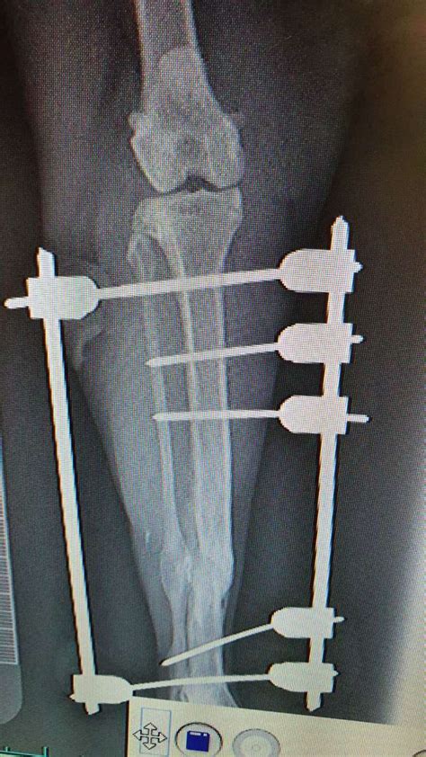 External Skeletal Fixation Advanced Veterinary Services