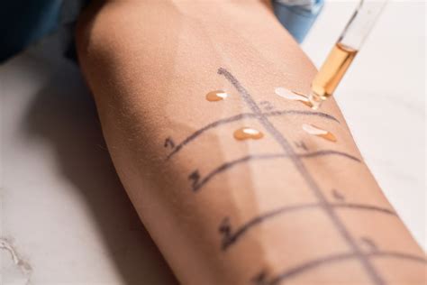 Dermatologia Medisport Center Perugia E Città Della Pieve