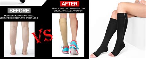 Ailaka Zipper Compression Socks 15 20 Mmhg Knee High Support For