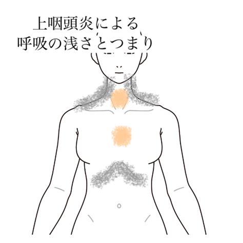 上咽頭炎による呼吸の浅さとつまり｜声が出しにくい、だるさのツボ｜ツボネット 鍼灸の症例が検索できるツボ辞典