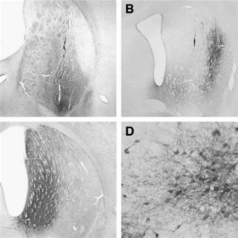 Transgene Expression Transgene Protein Expression Was Detected In The