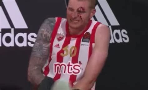 Stravična povreda košarkaša Crvene Zvezde VIDEO BL Portal