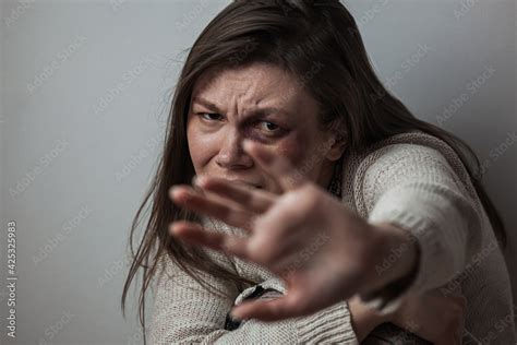 Domestic Violence Abuse Woman With Bruise On Face Fear And Defending