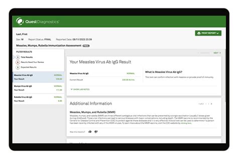 Measles Mumps Rubella Titer