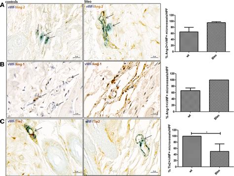 Expression Of Angtie2 In Dermal Microvessels Of Bleomycin Challenged
