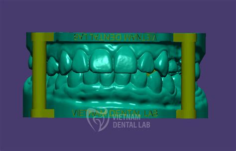 Simple Model Model Design Services Vietnam Dental Lab