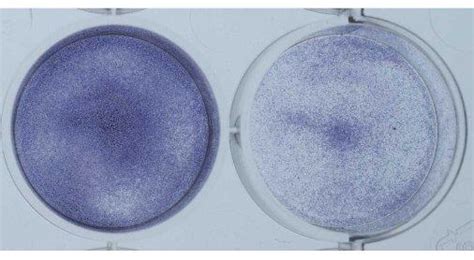 Gist Cell Line Experiments Center For Cancer Research