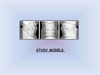 Space Analysis PPTX Dental Health Diseases And Conditions