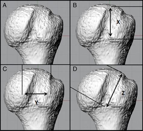 A Three Dimensional Reconstruction B Measurement Of The Craniocaudal Download Scientific