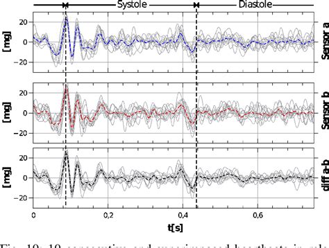 Figure 10 From A Differential Bcg Sensor System For Long Term Health Monitoring Experiment On