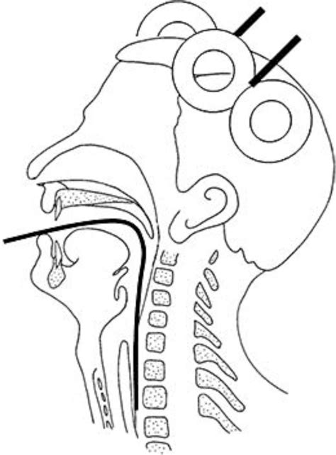 Rtms Protocol A Figure Of Eight Coil Was Positioned Over The Cortical