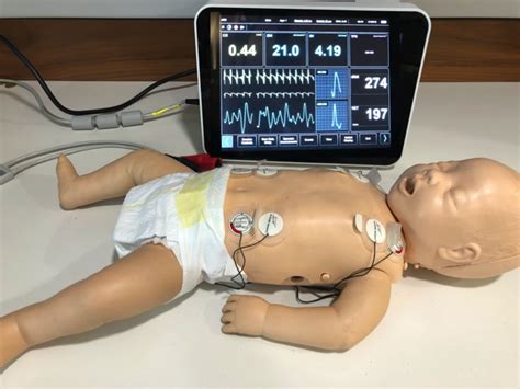 Feasibility Of Non Invasive Cardiac Output Monitoring At Birth Using Electrical Bioreactance In