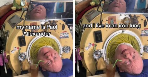Inspirational People Remembering Paul Alexander One Of The Last Polio