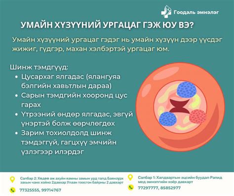 Гоодаль Умайн хүзүүний ургацаг гэдэг нь умайн хүзүүн дээр үүсдэг жижиг гүдгэр махан