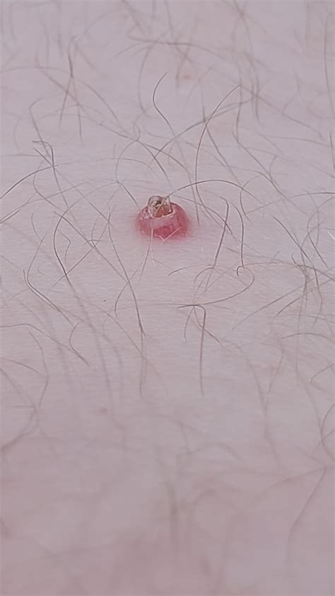 What Might This Be R Medical Advice