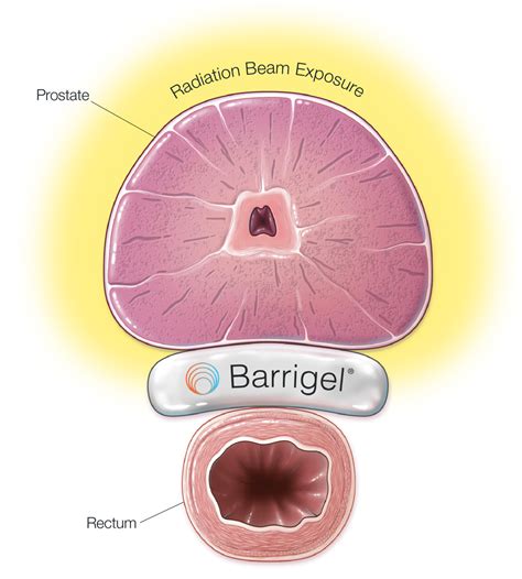 Trusted Prostate Cancer Diagnosis In Rancho Mirage