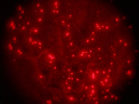 Immuno Fluorescence Loewe Biochemica Gmbh