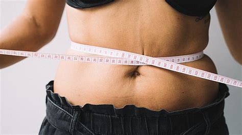 Cirurgia Bariátrica Tipos Quando Fazer Vantagens E Riscos