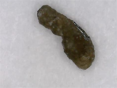 Is This Head Lice Lice Eggs Microscope View Rlice