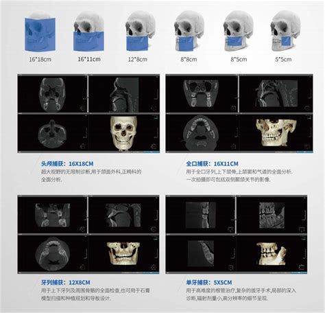 Ai Cbct Bondream D Pro